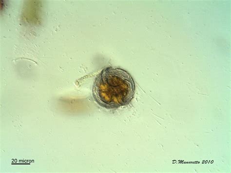 Peridinium Microscope