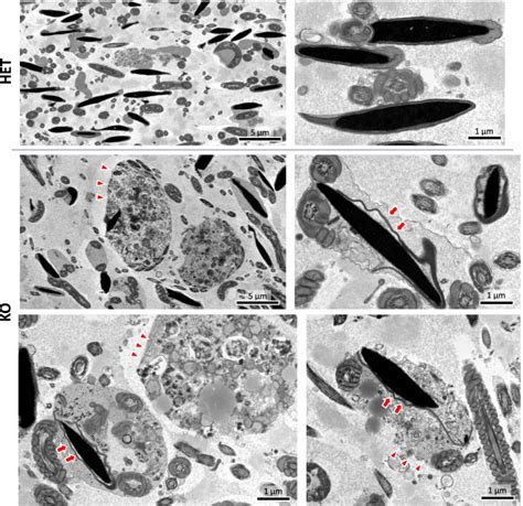 The Testis Specific E3 Ubiquitin Ligase Rnf133 Is Required For Fecundity In Mice Pmc