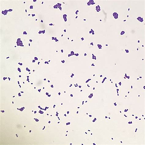 Pathology Outlines Listeria Monocytogenes