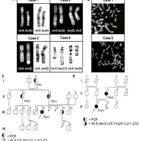 Conventional Cytogenetics Partial Karyotype Of Cases 14 Through Qfq
