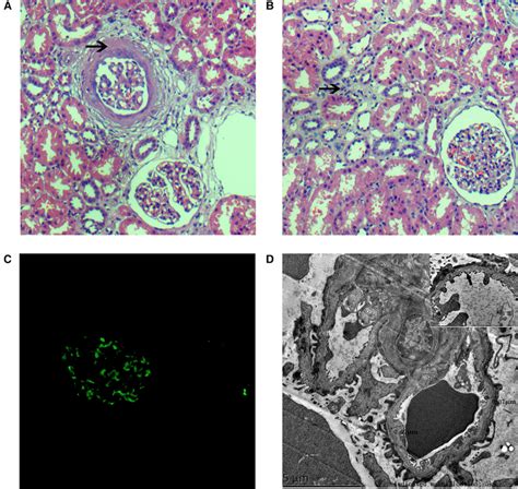Histopathologic Lesions A Hande Stain ×200 Showing Glomeruli Download Scientific Diagram