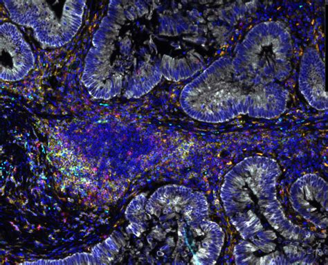 Multiplex Immunofluorescence Mif Services Discovery Life Sciences
