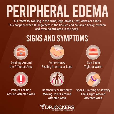 Edema Symptoms Causes And Natural Support Strategies