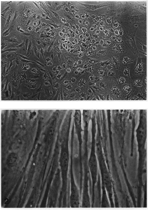 Phase Contrast Photomicrograph Of Cultured Glomerular Epithelial Cells Download Scientific