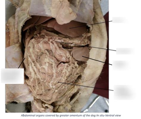 Diagram Of Abdo Organs Covered By Gomentum Steeplechase Quizlet
