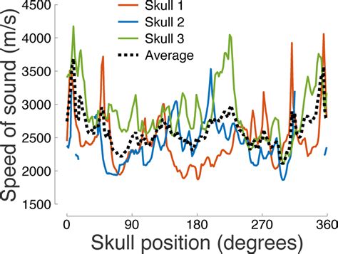Acoustic Properties Across The Human Skull Pmc