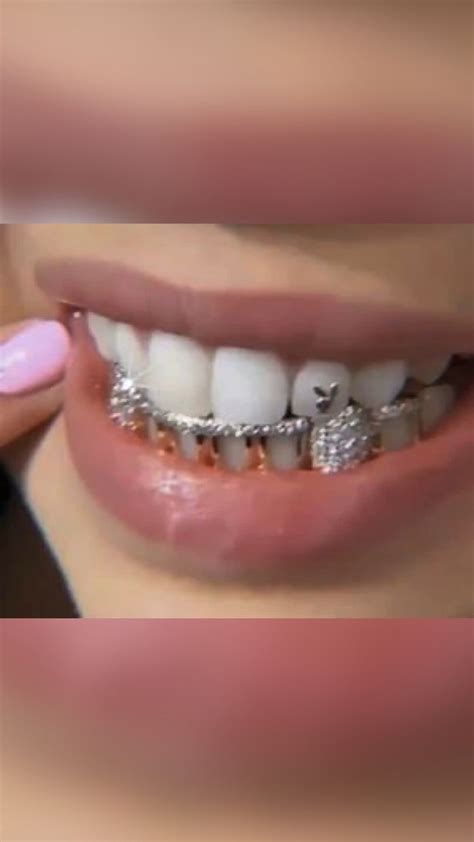 Grillz And Tooth Gems 💎