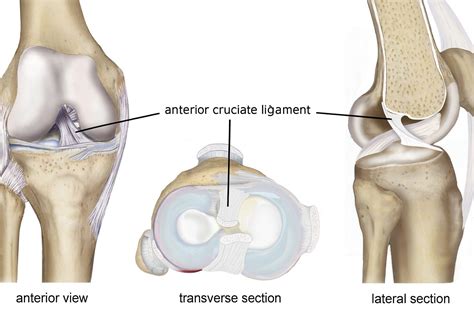 Anterior Cruciate Ligament Surgery Marcheggiani Muccioli