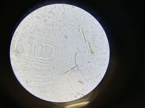 Help With Microscope Id Reef2reef Saltwater And Reef Aquarium Forum