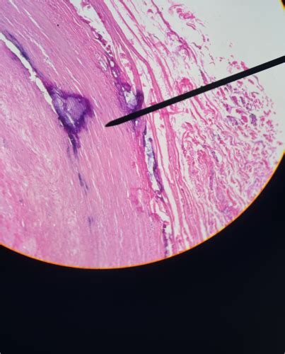 Bio 308 Lab Heart Quiz Flashcards Quizlet