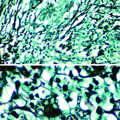 A Round To Oval Basophilic Bodies Surrounded By A Clear Halo In The