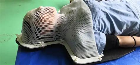 Radiotherapy Thermoplastic Mask Head Neck Shoulder Immobilization