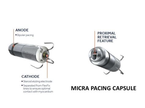 Micra™ Wireless Permanent Pacemaker