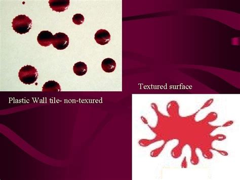 Serology Blood Stain Patterns Stain Patterns Of Blood