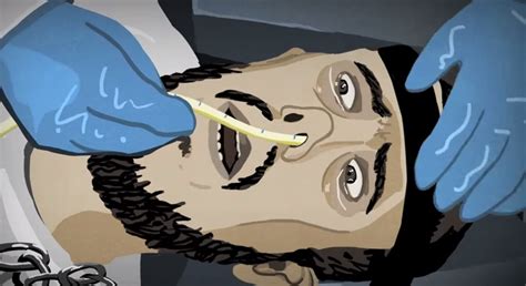 Force Feeding Animation No 1 רופאים לזכויות אדם