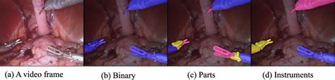 Figure 4 From Real Time Instrument Segmentation In Robotic Surgery