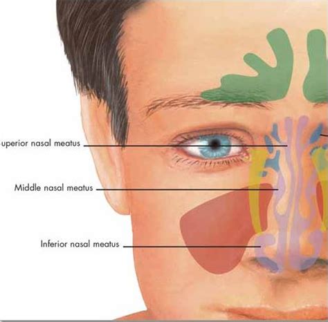Rhinitis And Sinusitis Chart Vr1251 Anatomical Parts And Charts
