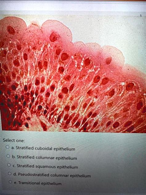 Solved Select One Stratified Cuboidal Epithelium B Stratified Columnar Epithelium Stratified