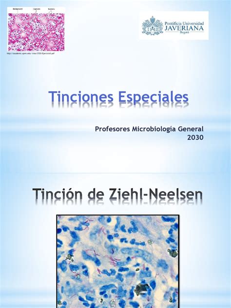 Coloracioesn De Shaffer Fulton Ziehl Neelsen 2030 Pdf Microbiología