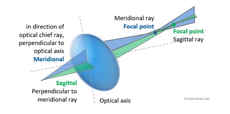 Optical Errors Coma Asymmetry Error And Astigmatism Dotlessness