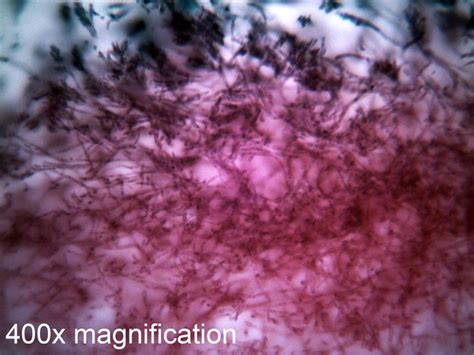 Penicillium Slide