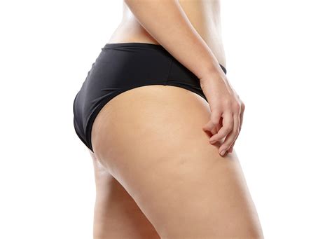 Celulite Nara Fugimoto Dermatologia