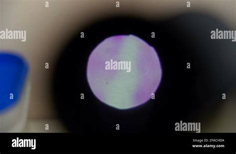 Gonorrhea Agar Stock Videos And Footage Hd And 4k Video Clips Alamy