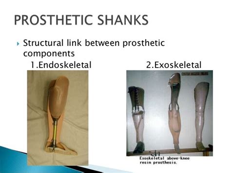 Exoskeleton Vs Endoskeleton Prosthesis