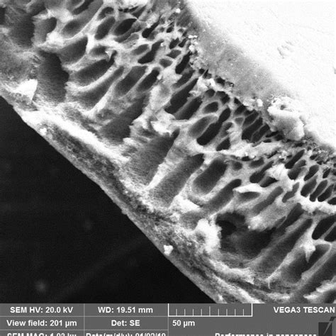 Effect Of Pes Polymer Concentration On The Porosity Of The Membranes