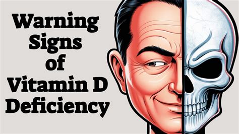 12 Warning Signs Of Vitamin D Deficiency Youtube