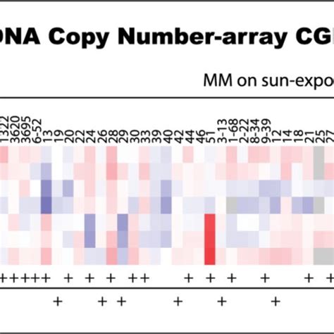 Gab2 Amplifications In Melanoma By Array Based Comparative Genomic Download Scientific Diagram