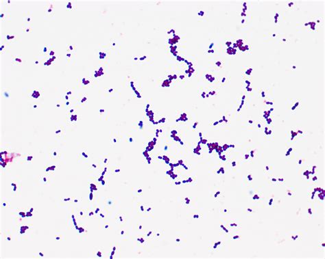 Enterobacter Aerogenes Capsule Stain