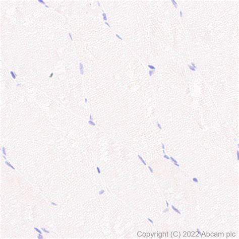 Anti Cd40 Ligand Antibody [epr26530 17] Ab303610 Abcam