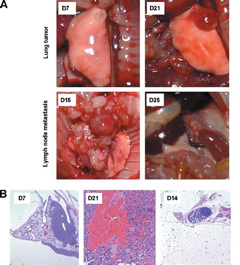 Mediastinal Lymph Nodes Mouse