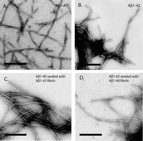 Tem Analysis Of Fibrillar Morphologies A Fibrils Of Aβ 1 40 Acquired