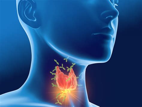 Is Heavy Metal Poisoning Causing My Thyroid Symptoms