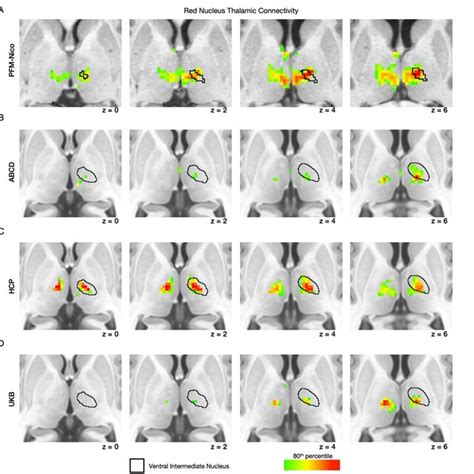 Functional Connectivity Subdivisions Of The Red Nucleus A Anatomical