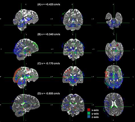 Biomedical Engineering Bme