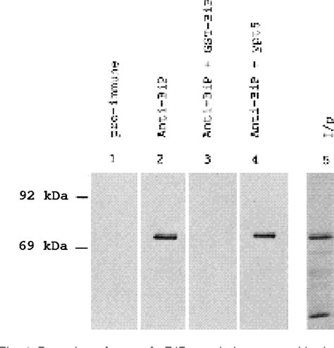 Figure 1 From The Bip Protein And The Endoplasmic Reticulum Of