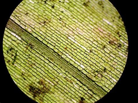 Elodea Cells Under A Microscope