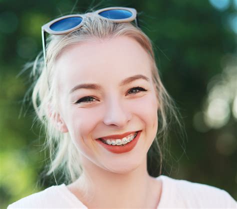 Clear Braces Brisbane Ceramic Braces Smilestyle Orthodontics