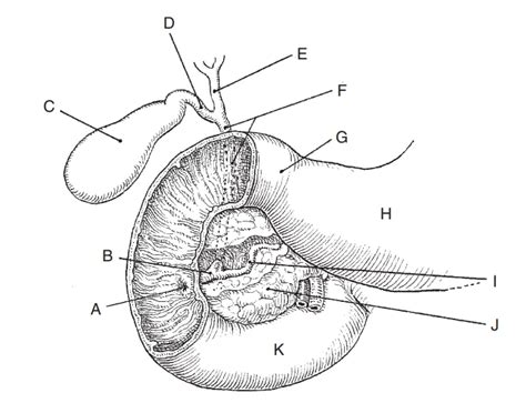 Duodenal Loop Quiz