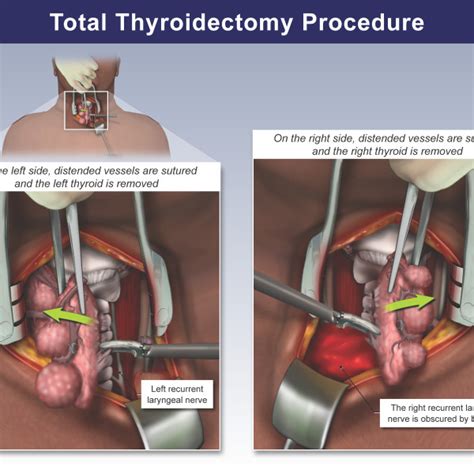 Cystogram Procedure Trial Exhibits Inc
