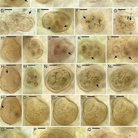 Different Types Of Microscopic Vesicles Containing Spherical Bodies