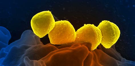 Hausse Des Cas Dinfection Invasive Au Streptocoque A Comment Il Se