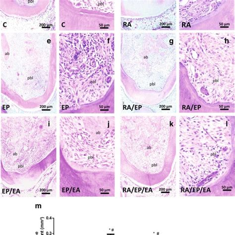 Histometric Analysis Of Area Of No Bone Or Periodontal Ligament Anbl