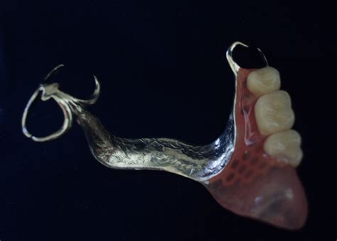 Removable Prostheses Edl Dent