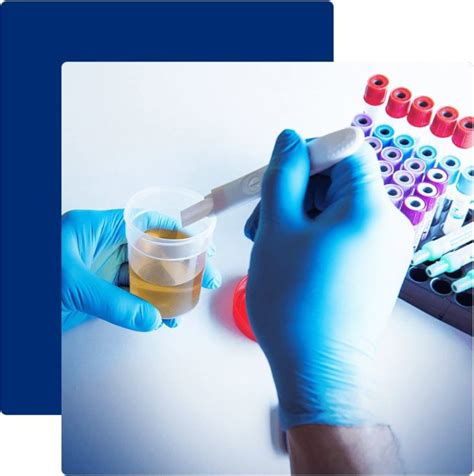 Beta HCG Test Dubai Alpha Medical Laboratory