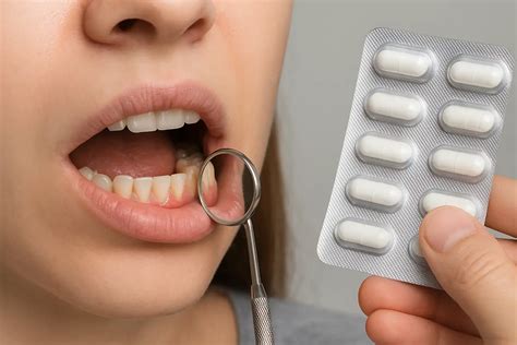 Do You Need Antibiotics For Gum Infection A Complete Evidence Based
