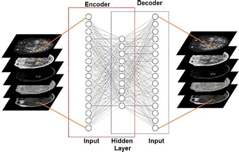 Illustration Of An Autoencoder Used To Learn A Low Dimensional Download Scientific Diagram